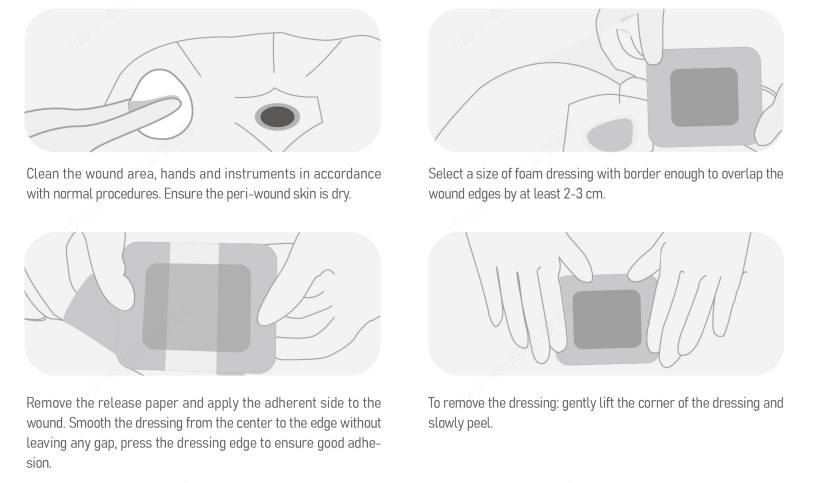 Foam Dressing with Border